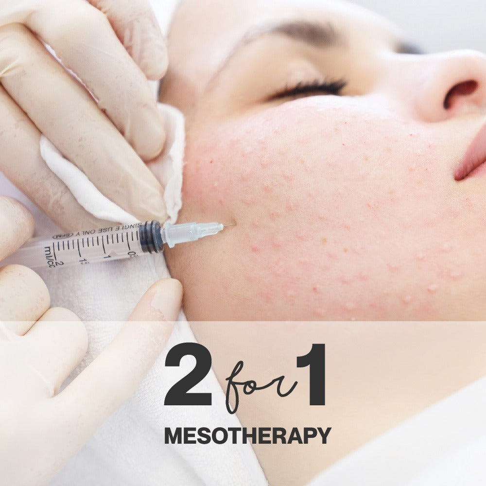 2 for 1 Mesotherapy Treatment | Skin Society