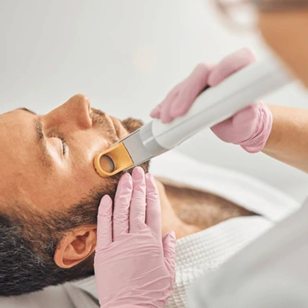 Laser Cheeks Man | Skin Society