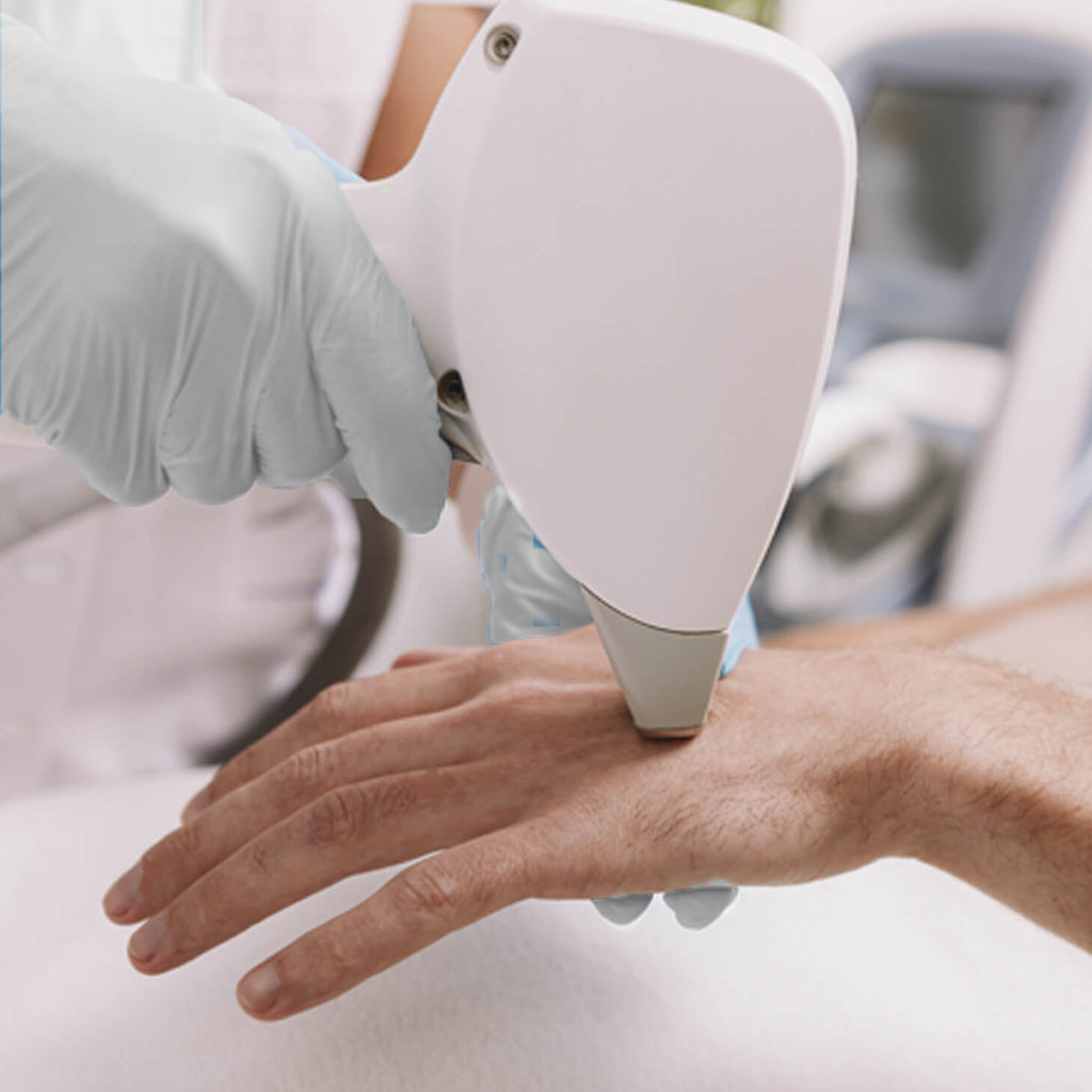 Laser Hands Man | Skin Society