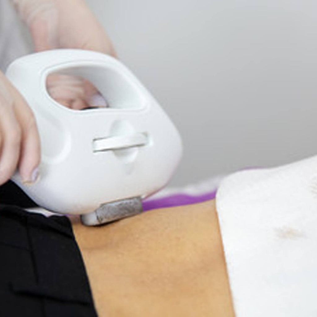 Laser Lower Back Man | Skin Society