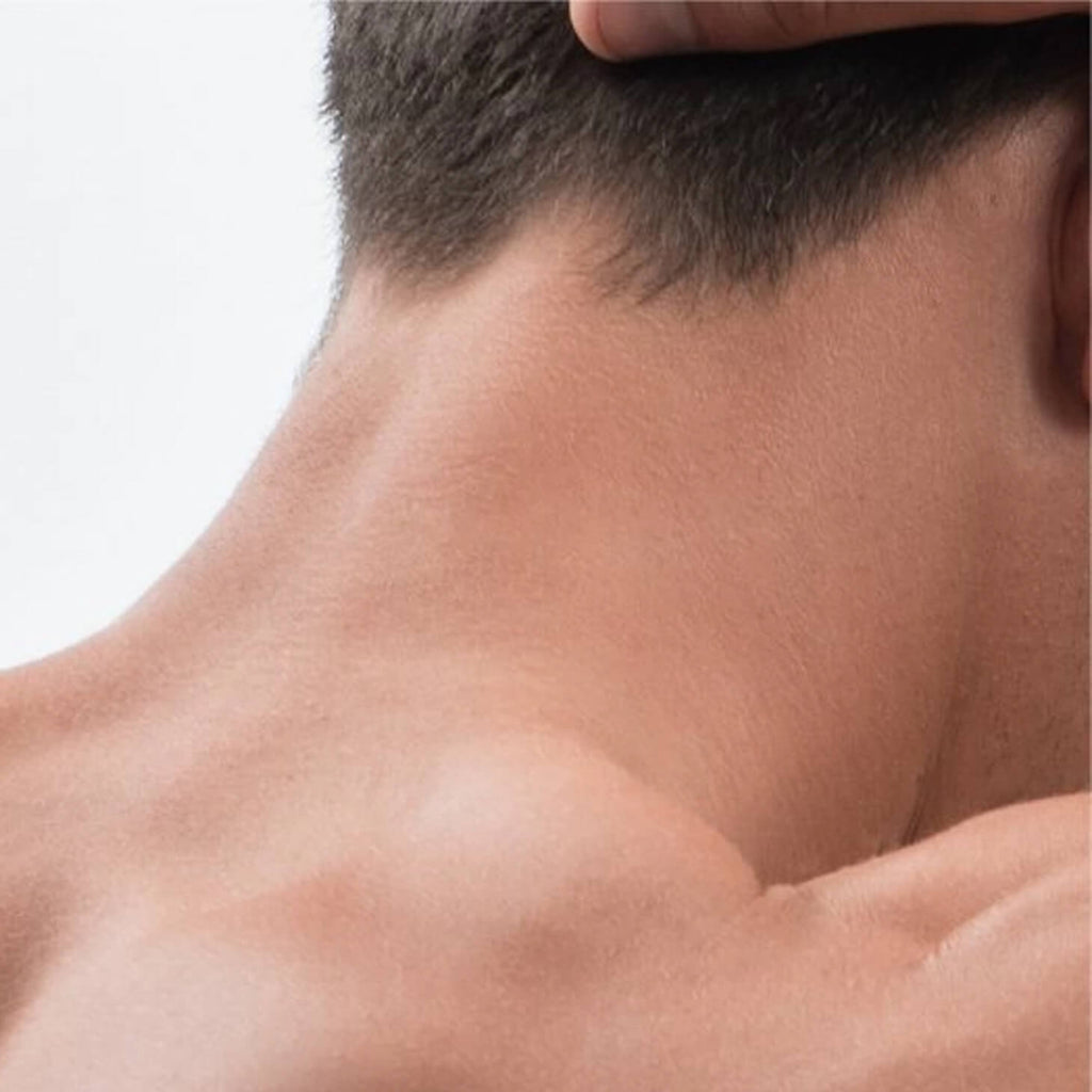 Skin Society the Clinic Laser Nape Man | Skin Society | Lebanon