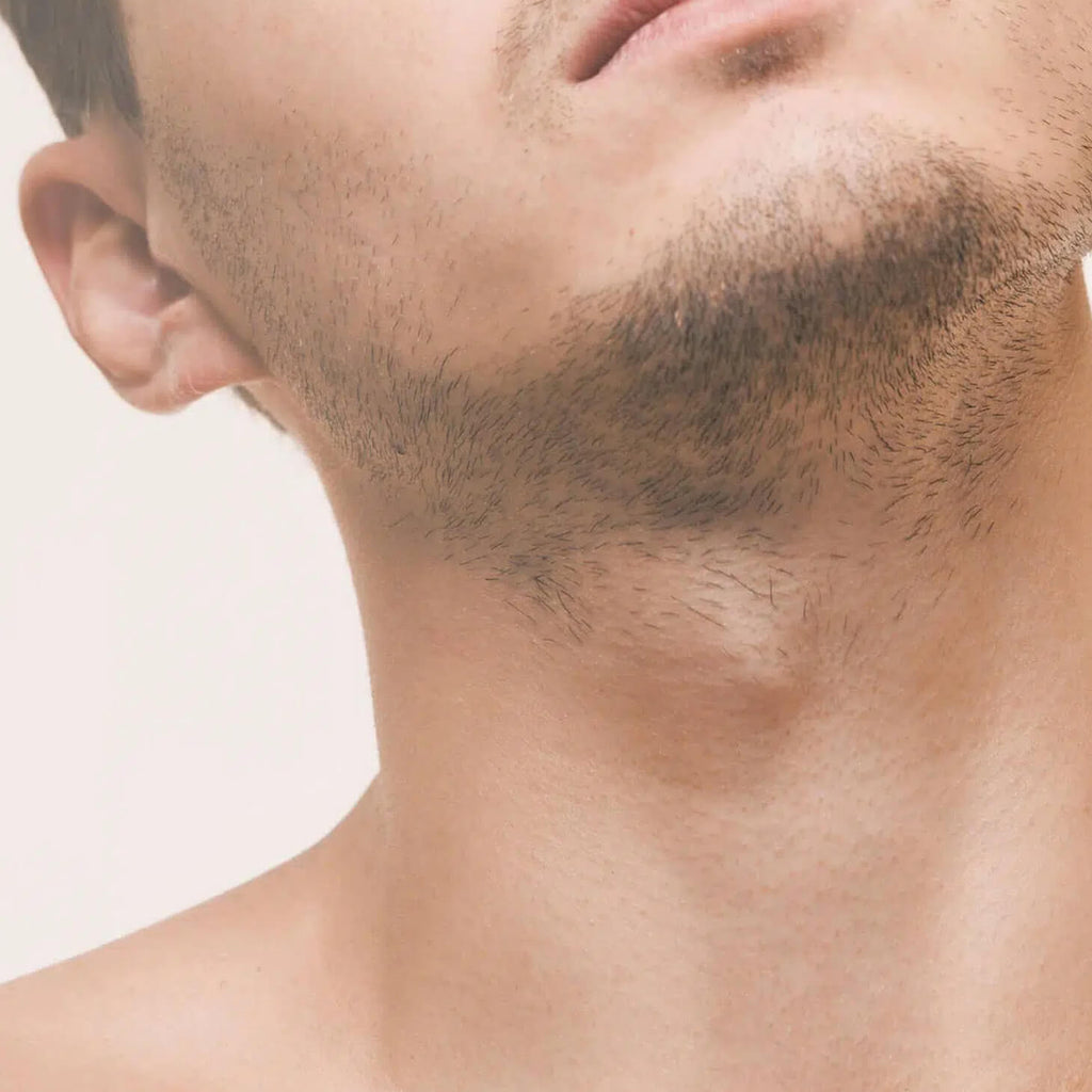 Laser Neck Man | Skin Society