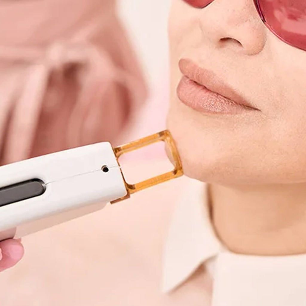 Laser Chin Tip Woman | Skin Society
