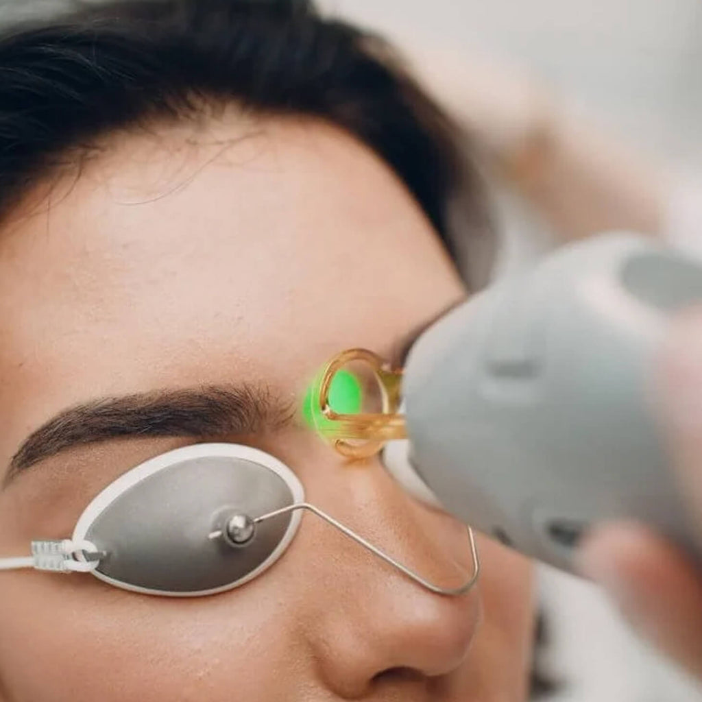 Laser Eyebrows Woman | Skin Society