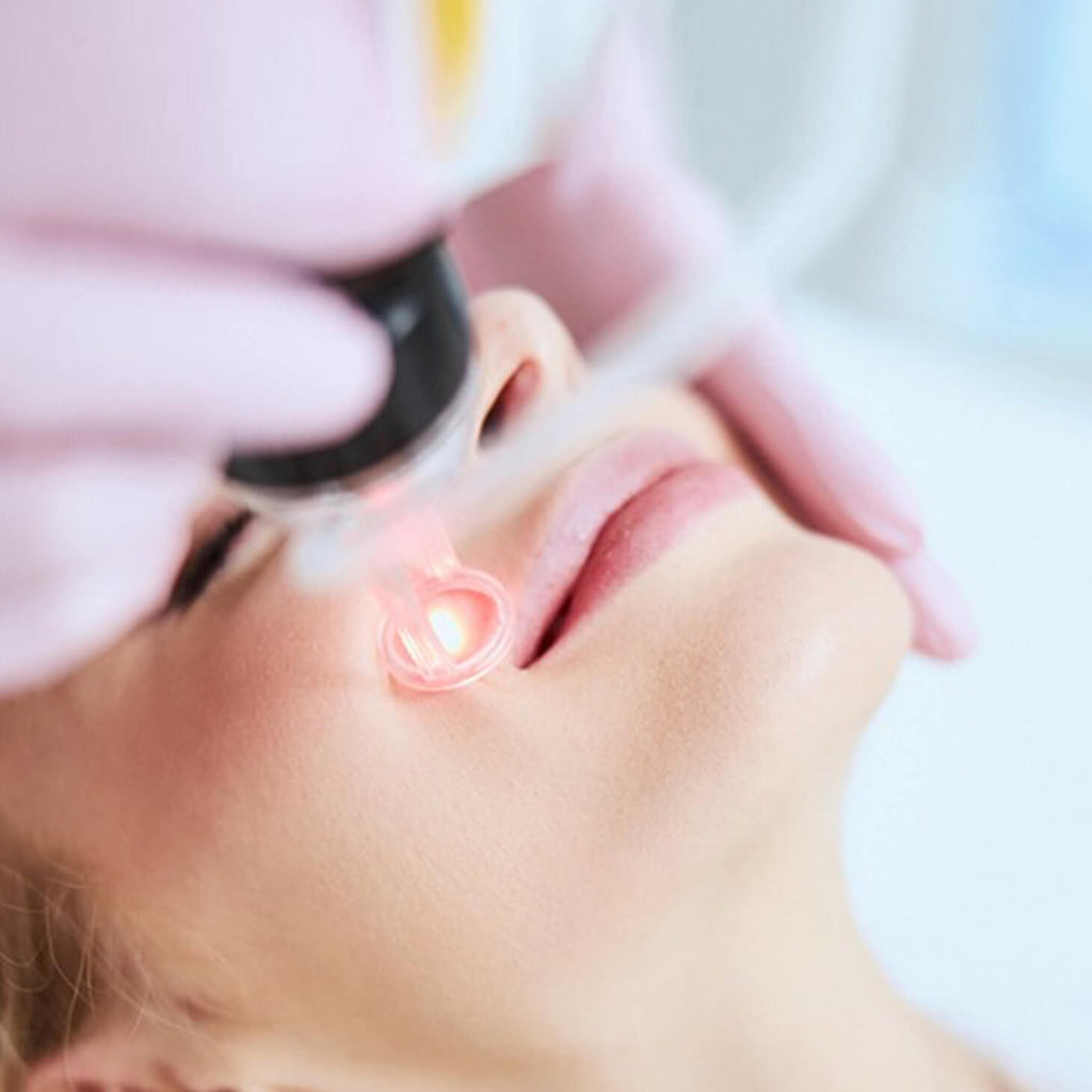 Laser Upper Lips Woman | Skin Society